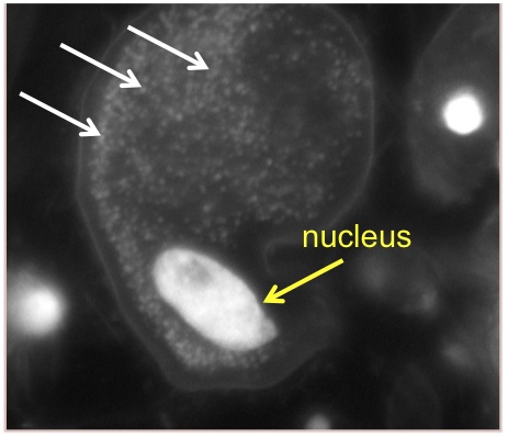 Termite gut microbes | MICROBES AND MORE