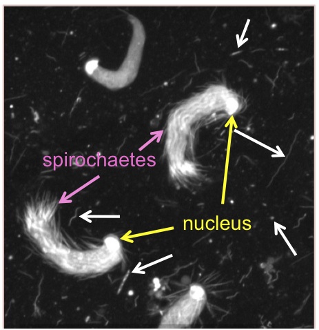Termite gut microbes | MICROBES AND MORE