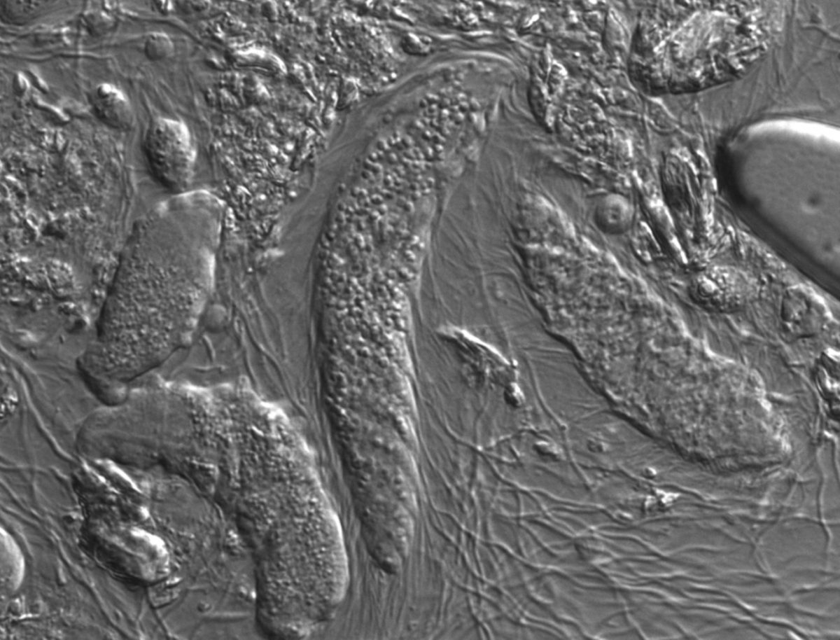 Termite gut microbes | MICROBES AND MORE