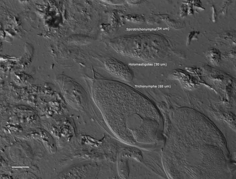 Termite gut microbes | MICROBES AND MORE