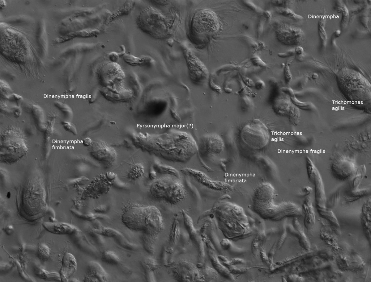 Termite gut microbes | MICROBES AND MORE