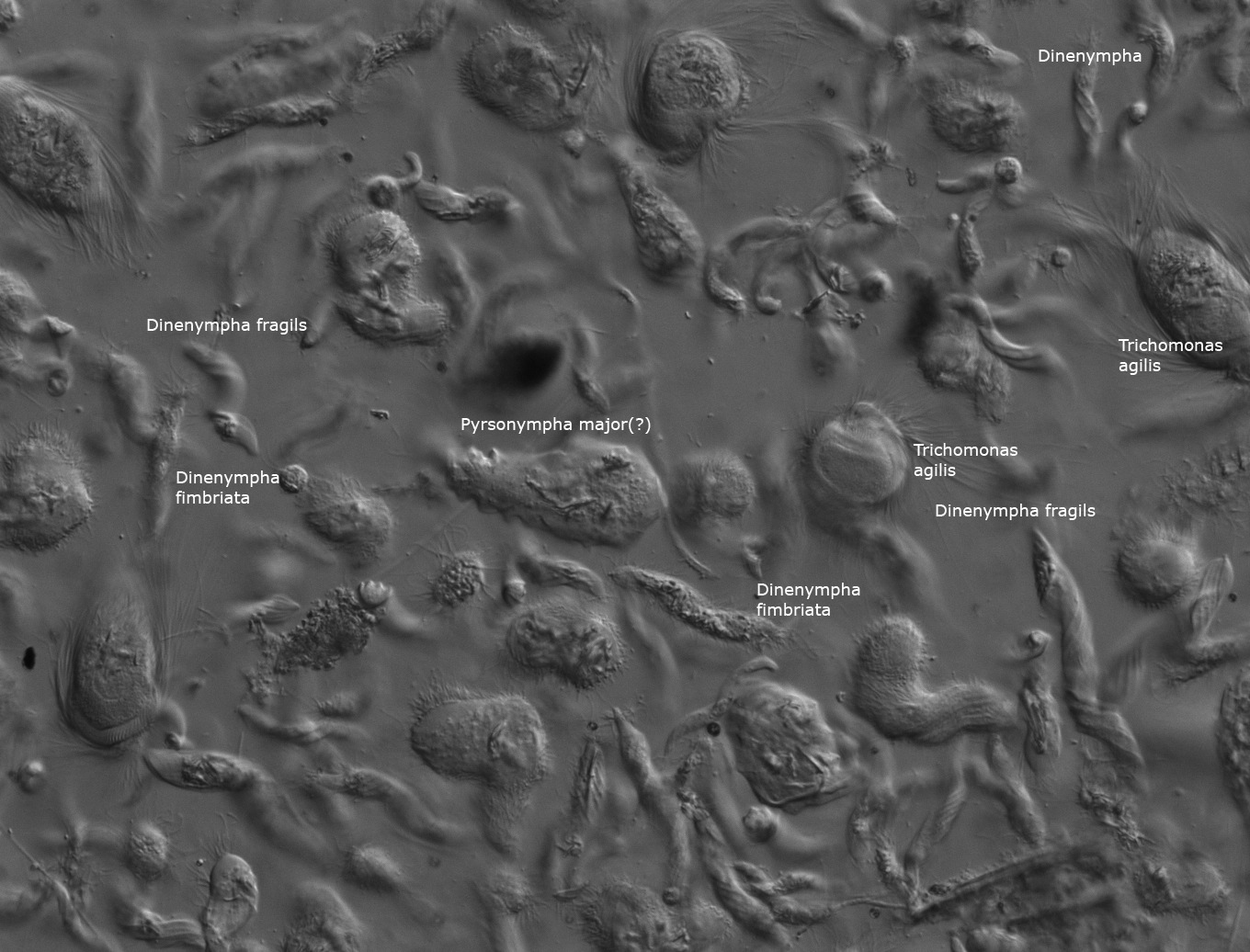 Termite gut microbes | MICROBES AND MORE