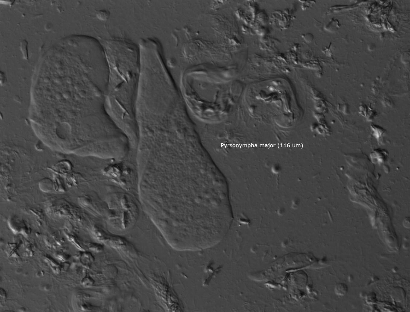 Termite gut microbes | MICROBES AND MORE