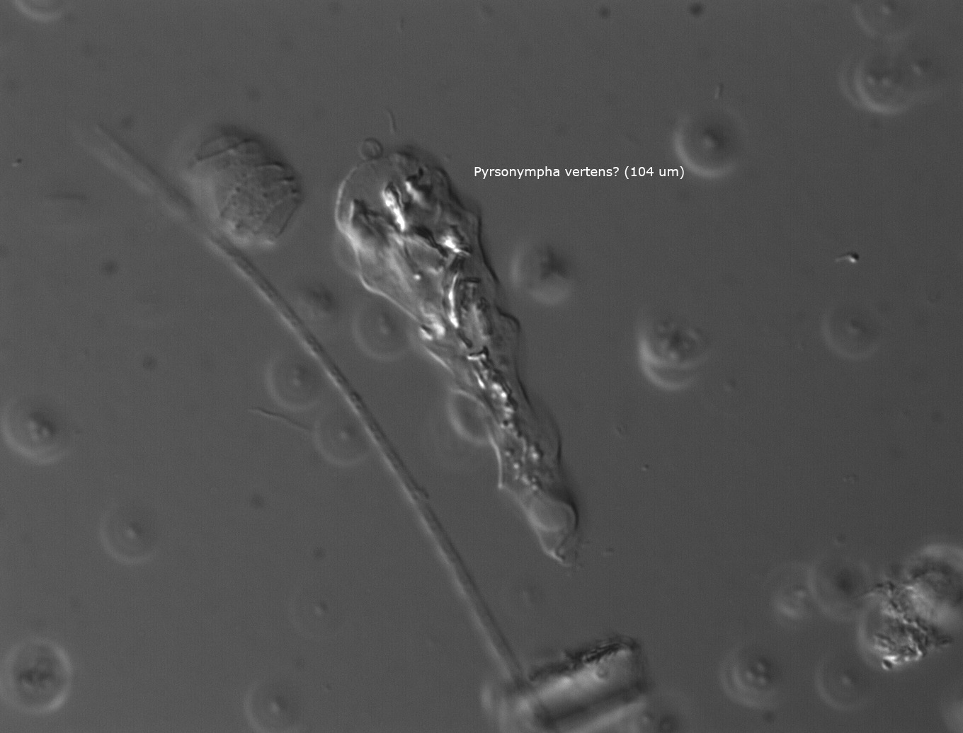 Termite gut microbes | MICROBES AND MORE