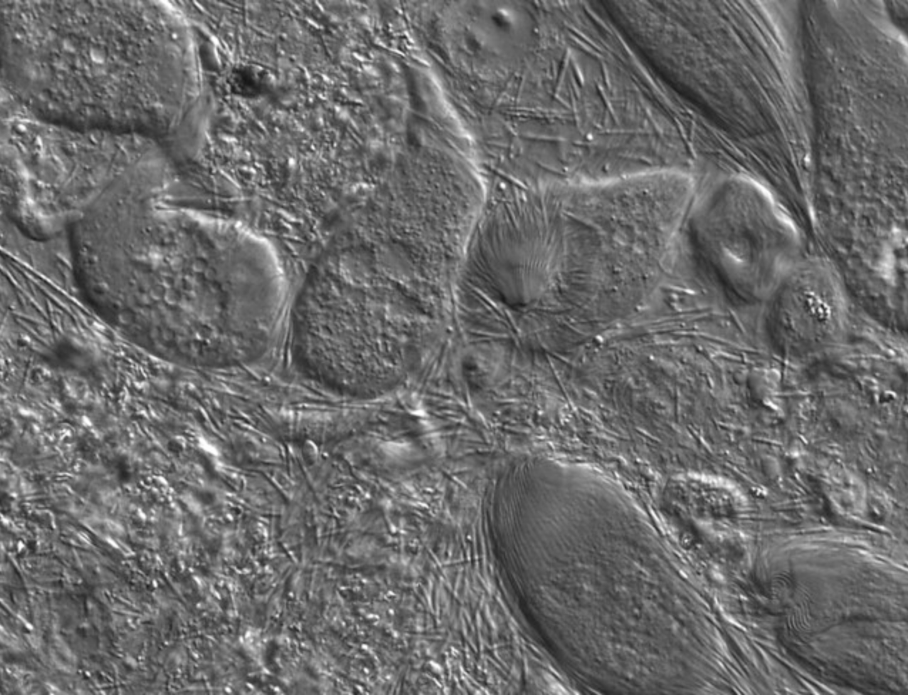 Termite gut microbes | MICROBES AND MORE